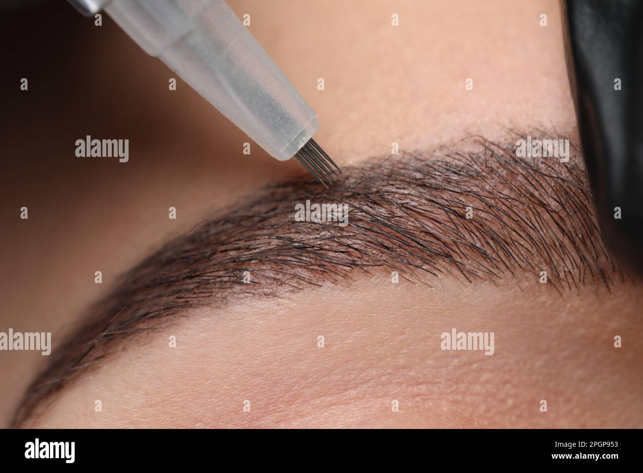 Procedure of permanent hi-res stock photography and images - Alamy