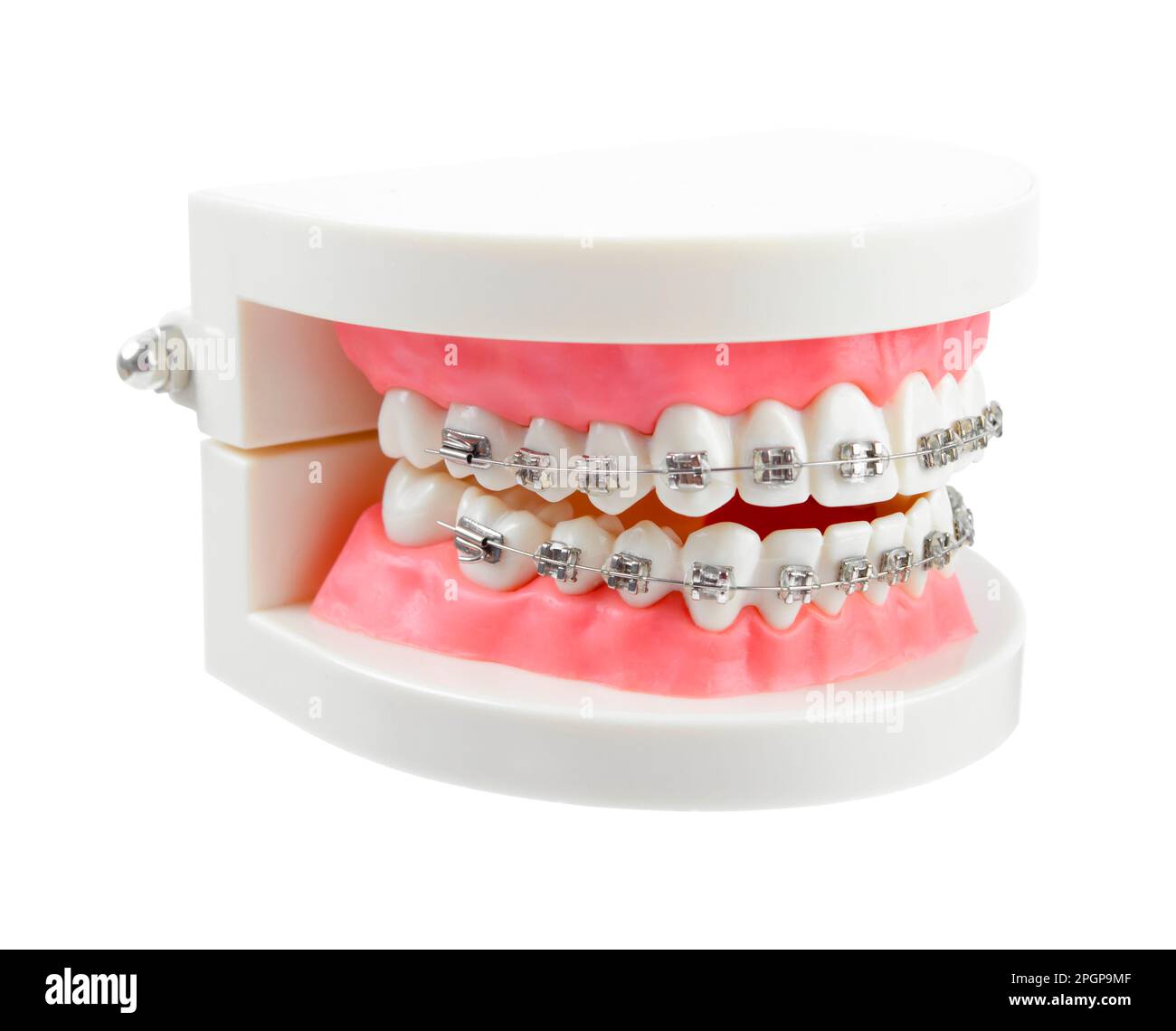 Teeth model with metal wire dental braces or dental instruments ...