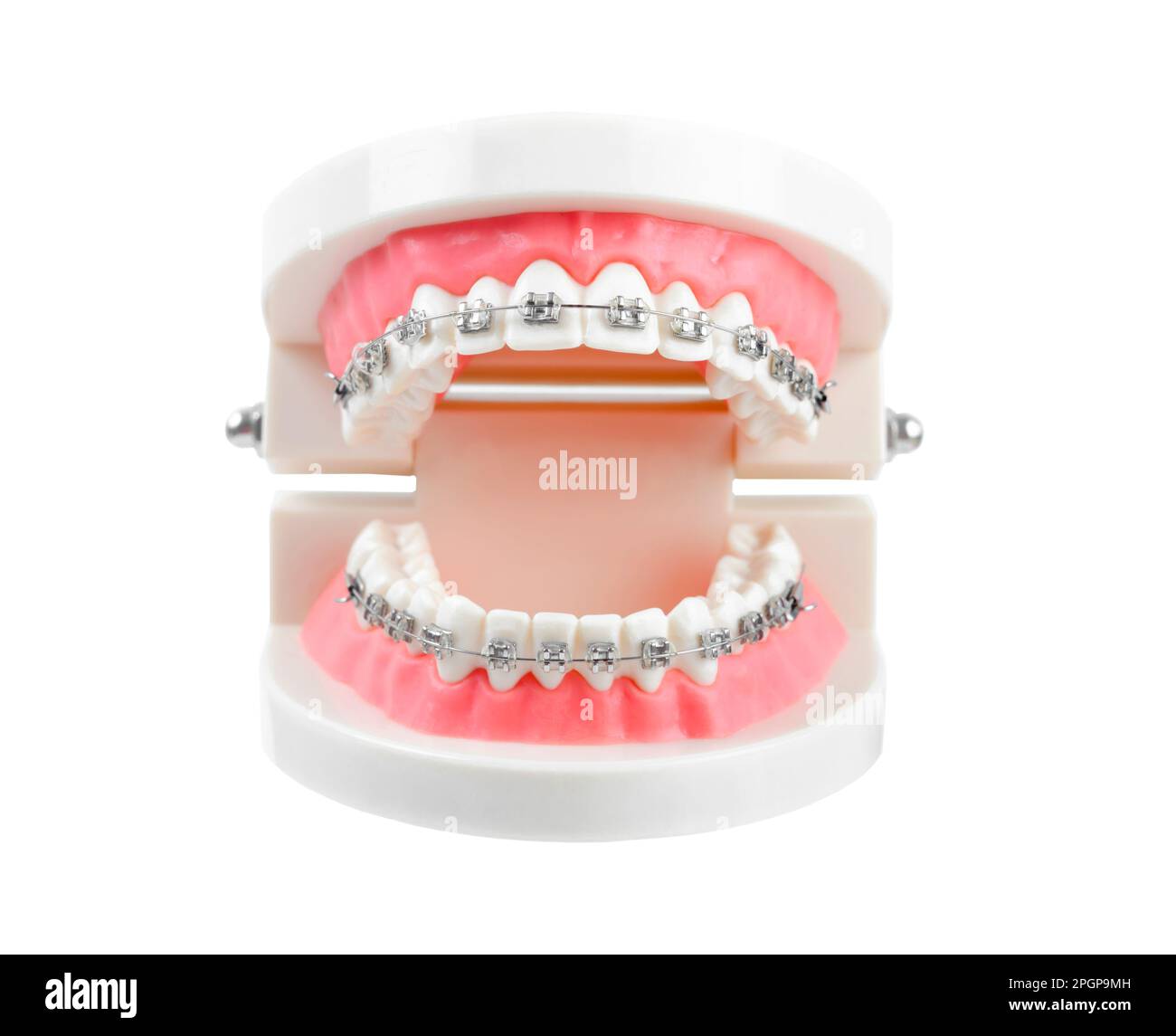 Teeth model with metal wire dental braces or dental instruments ...