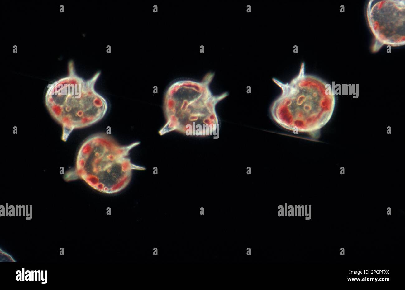 Peridinium Under Microscope