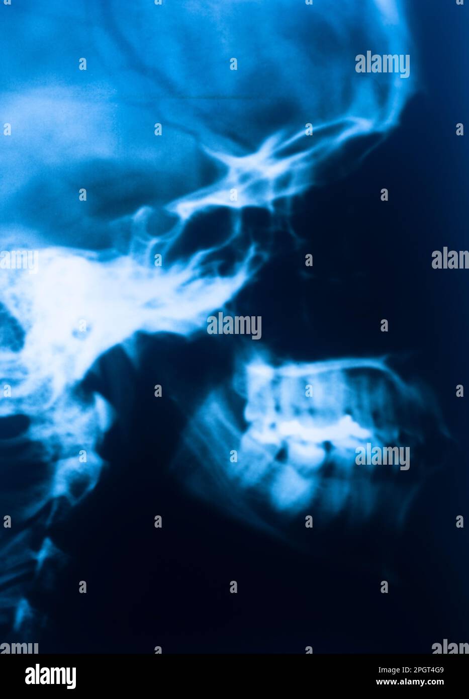Xray scan skull nose medical exam results from hospital clinic Stock ...