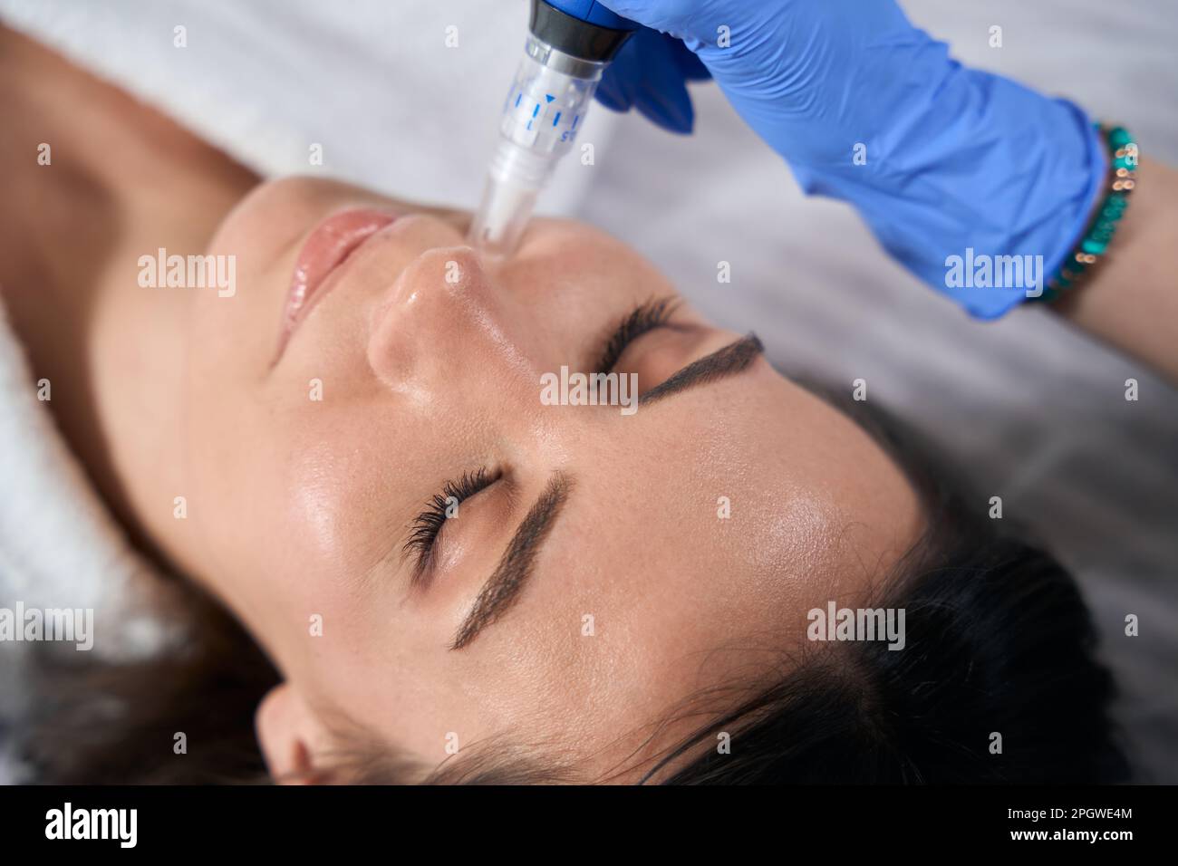 Nurse holding device for high-precision micromechanical skin remodeling ...