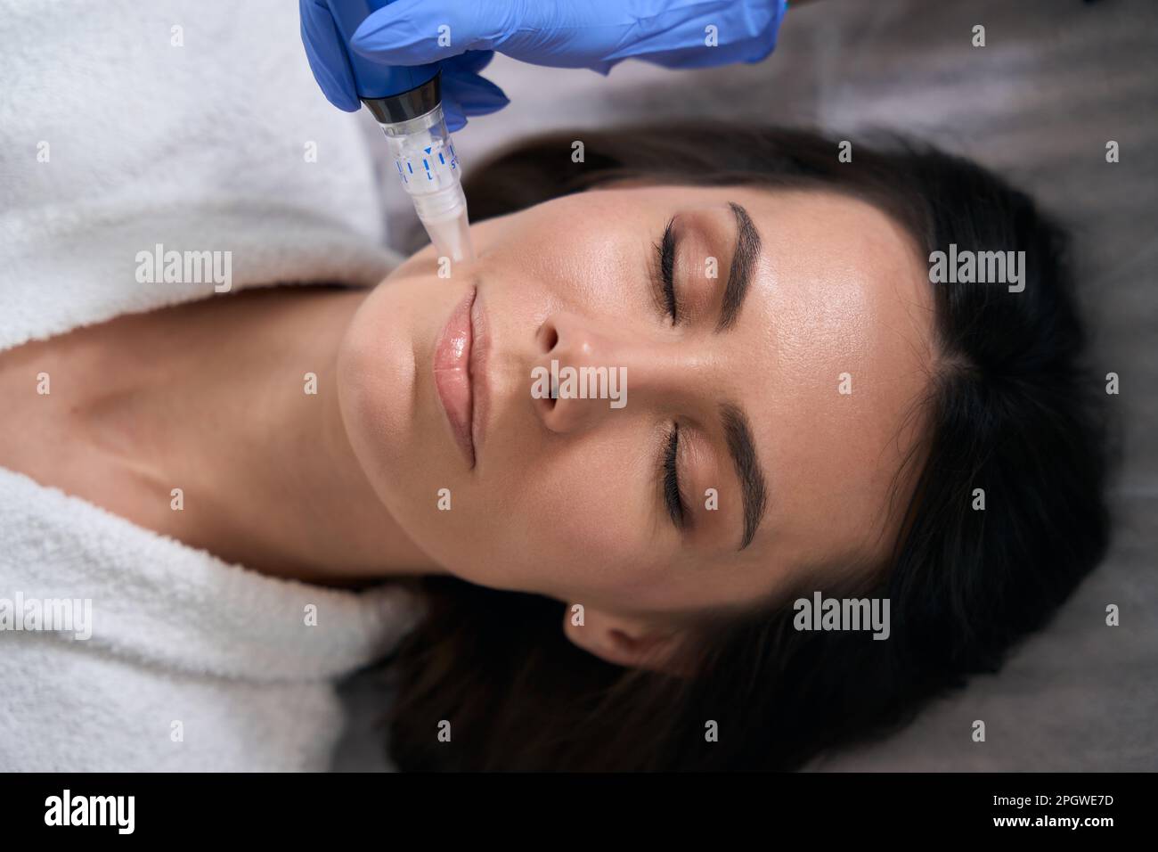 Close up photo of nurse doing face resurfacing procedure Stock Photo ...