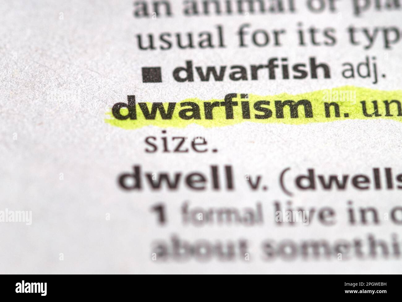Dwarfism hi-res stock photography and images - Alamy