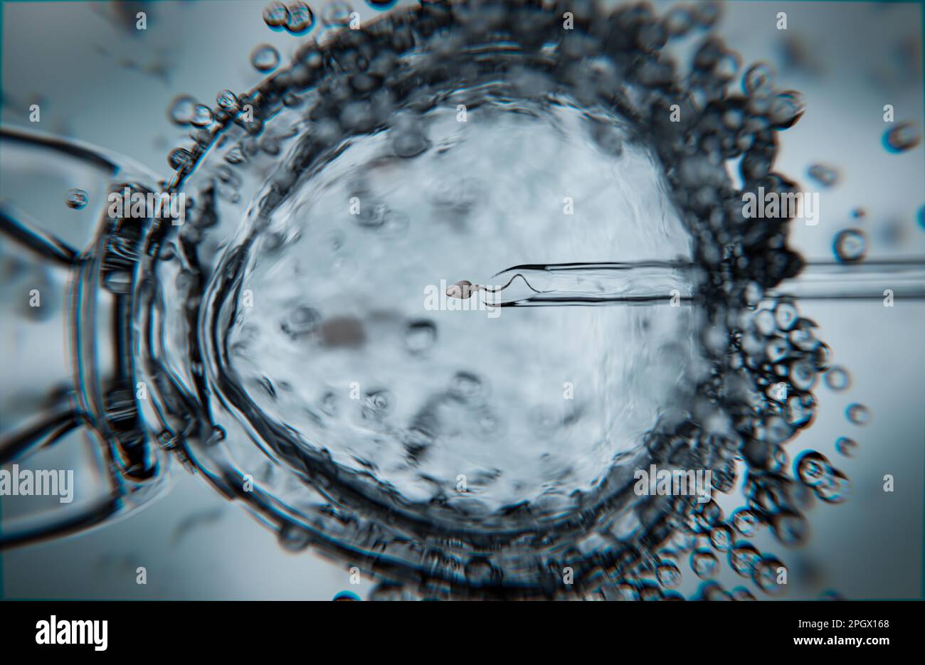 In vitro fertilization with intracytoplasmic sperm injection - 3d ...
