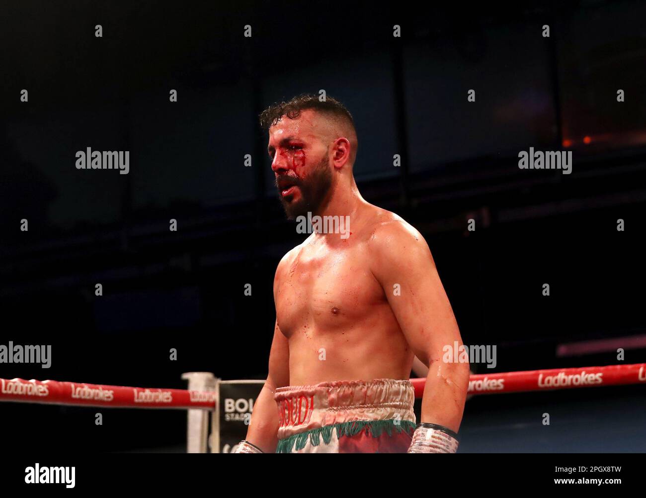 Fouad El Massoudi walks back to his corner after being injured during ...