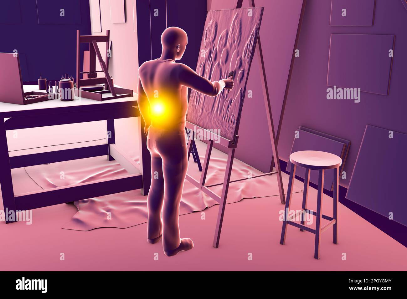 Artist with back pain, illustration Stock Photo - Alamy