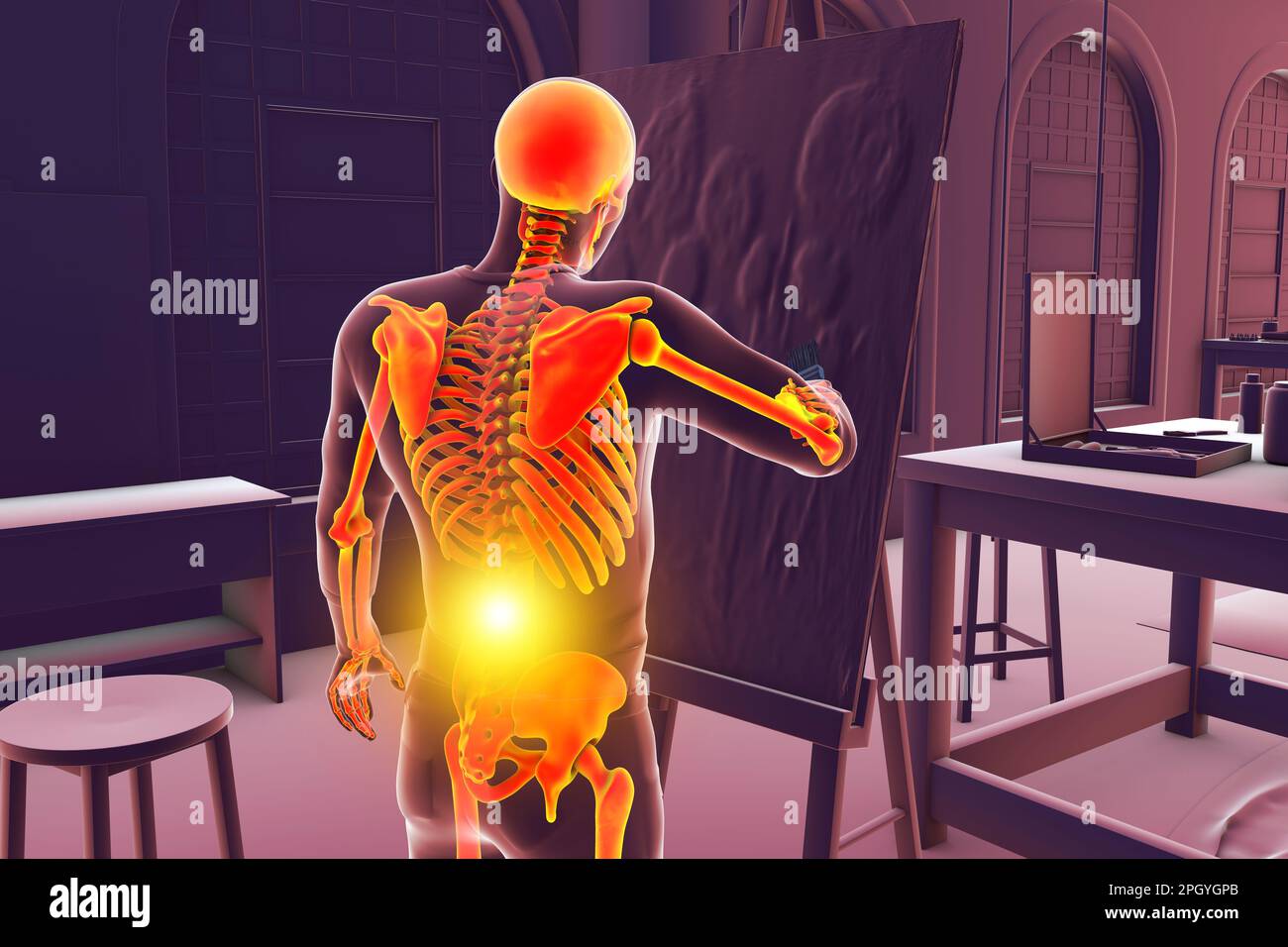 Artist with back pain, illustration Stock Photo - Alamy