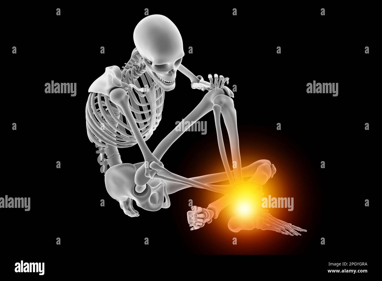 Ankle pain, illustration Stock Photo - Alamy