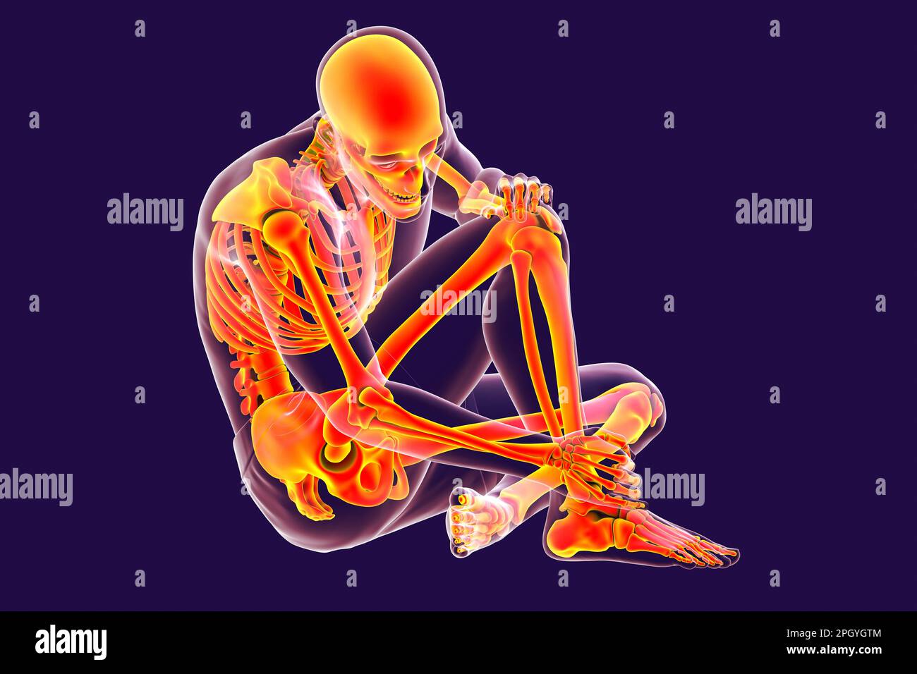 Ankle pain, illustration Stock Photo - Alamy