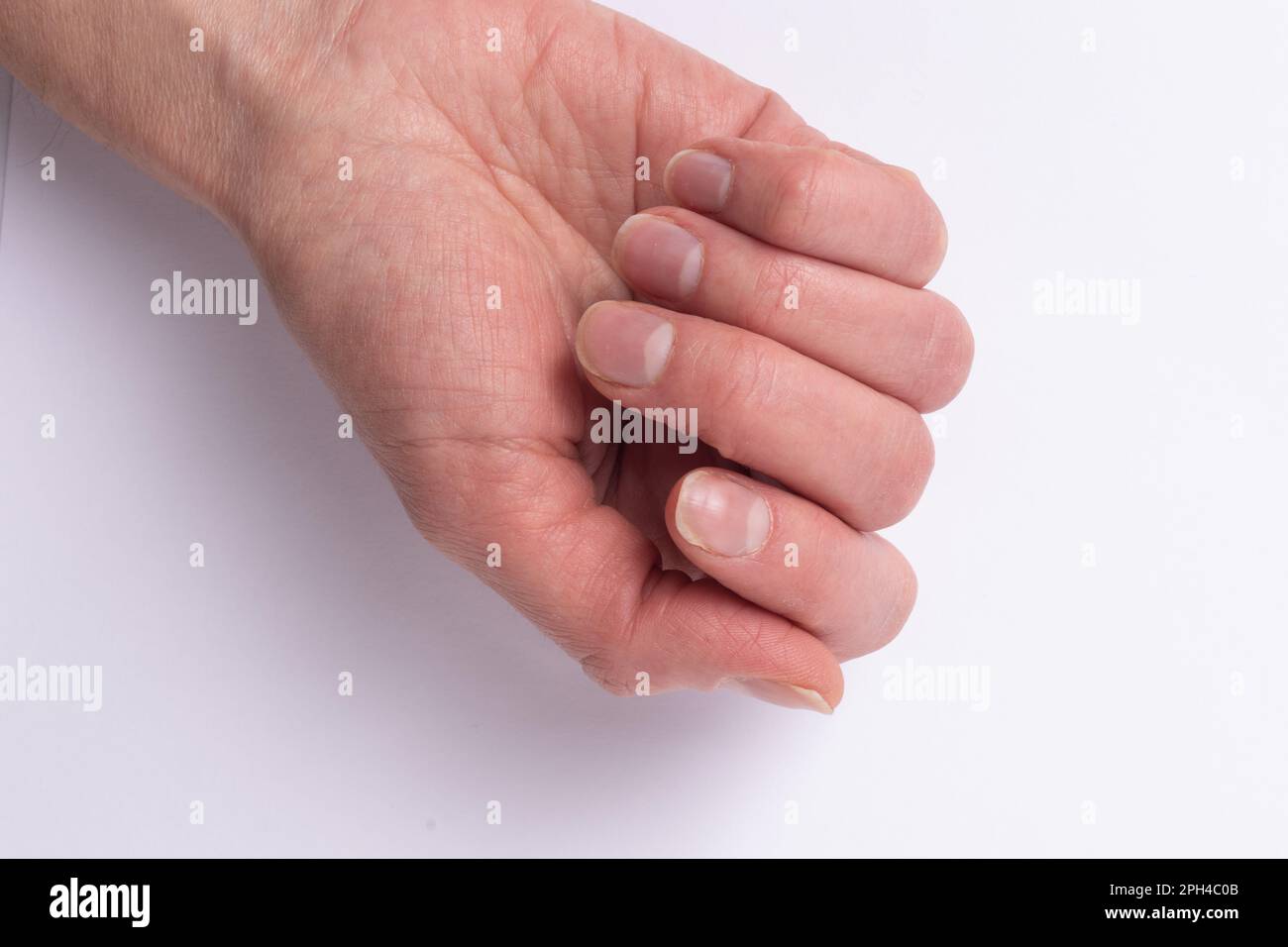 Close-up of female age-related hands with natural broken unhealthy ...