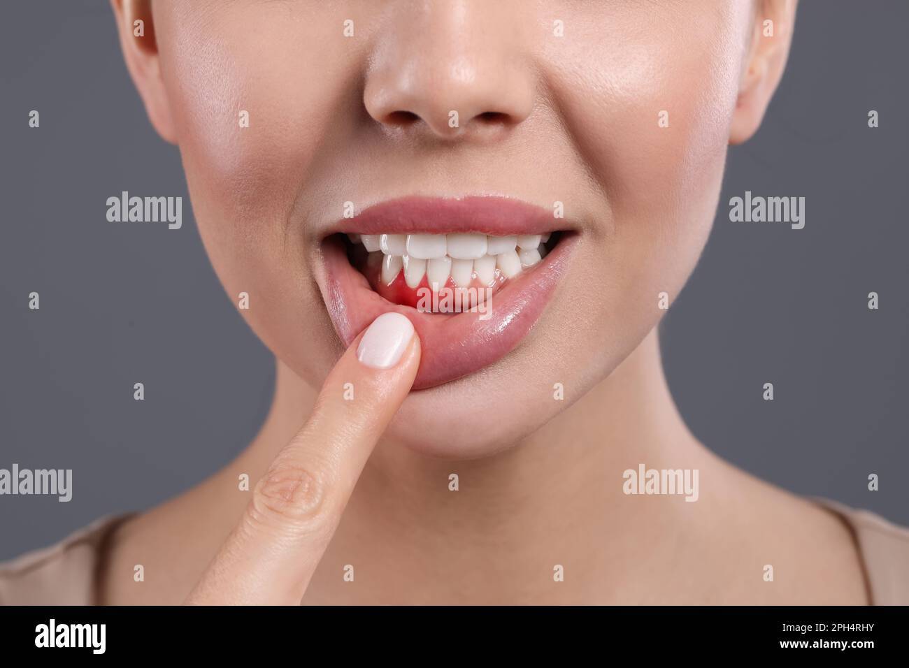 Young woman showing inflamed gums on grey background, closeup Stock ...