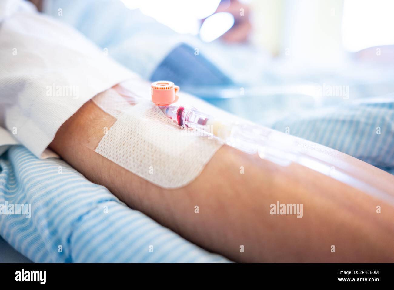 Venous catheter on a patient before an operation Stock Photo - Alamy