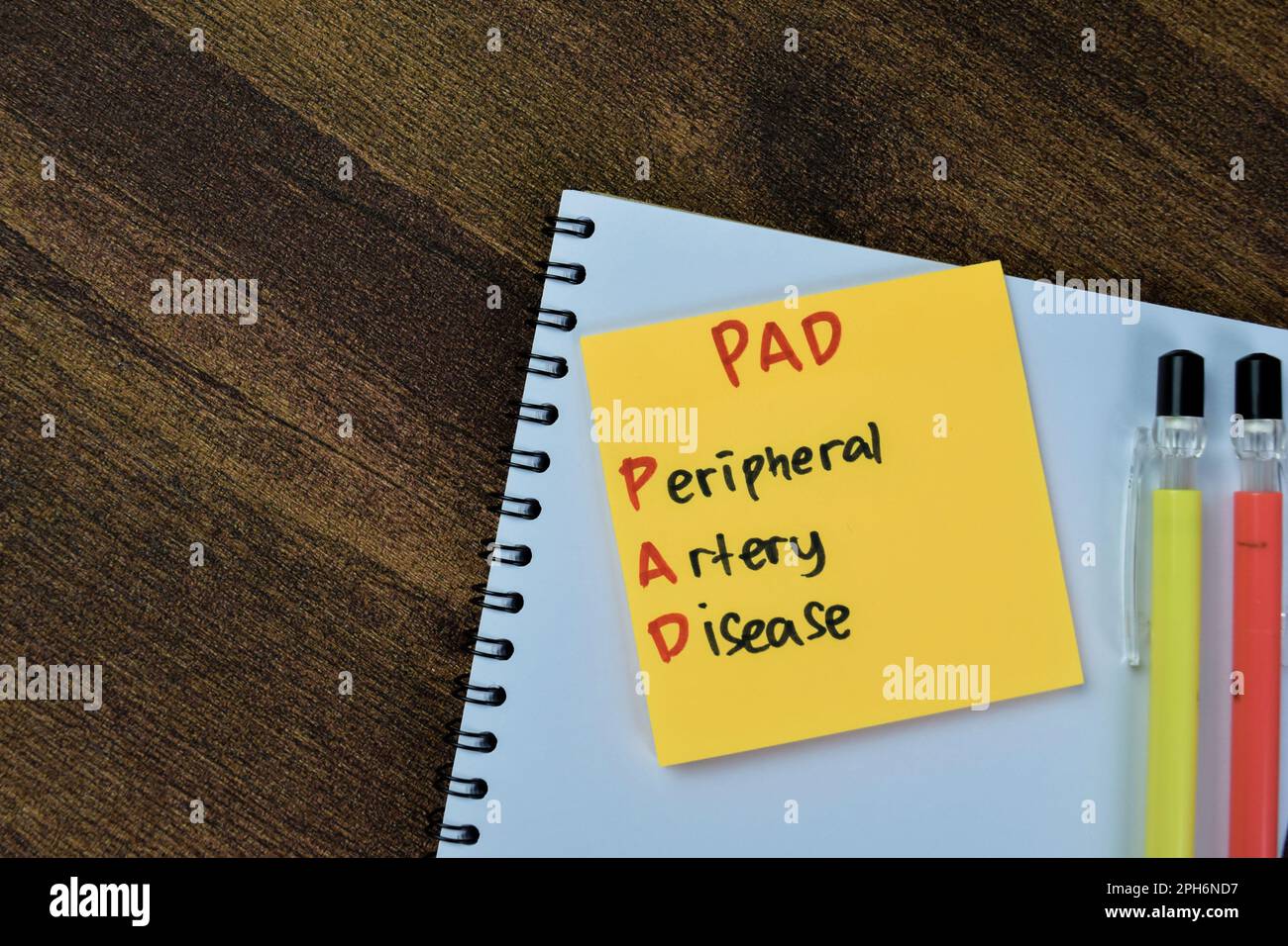 Concept of PAD - Peripheral Artery Disease write on sticky notes ...