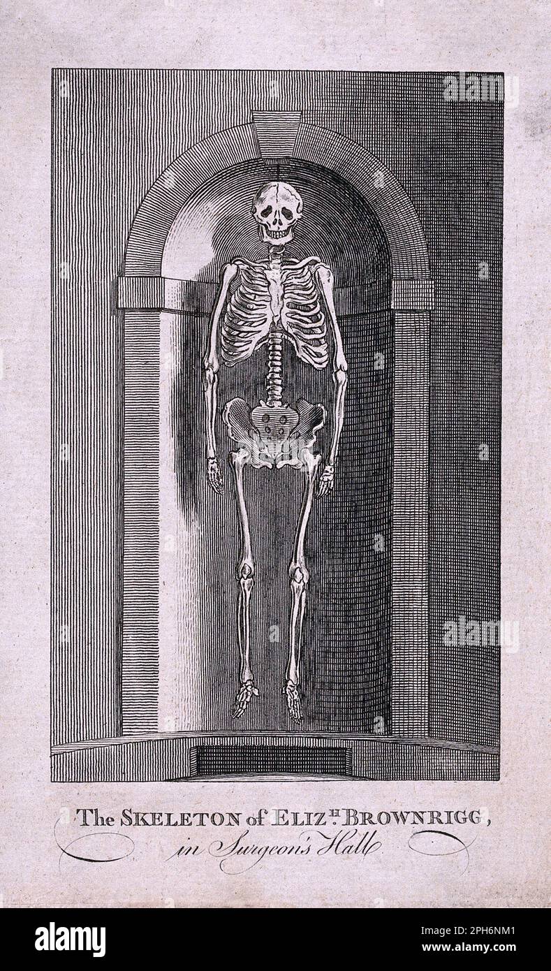 Elizabeth Brownrigg skeleton displayed in Surgeon's Hall, Old Bailey ...