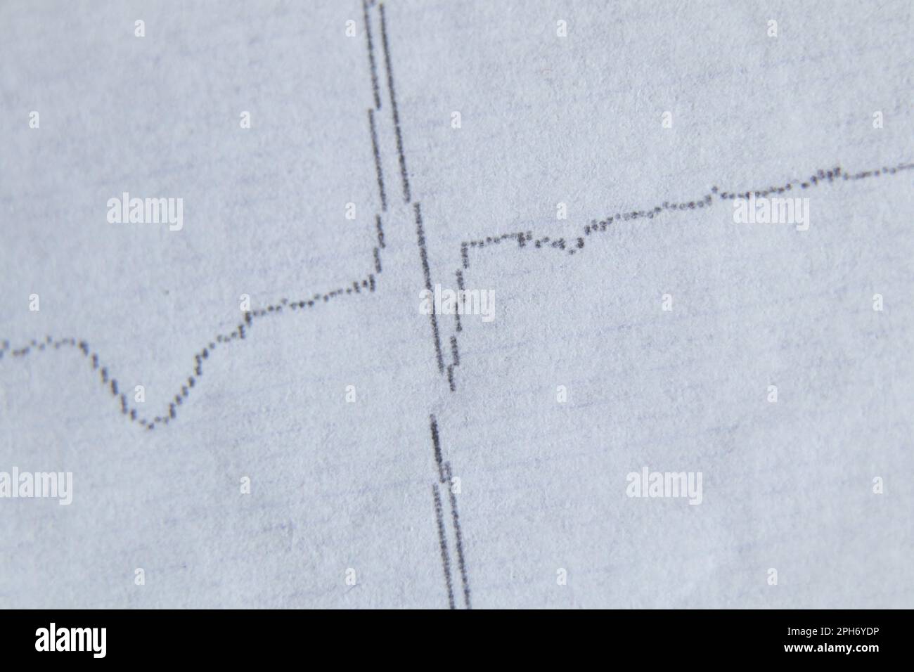 cardiogram on old paper as background macro photo Stock Photo - Alamy