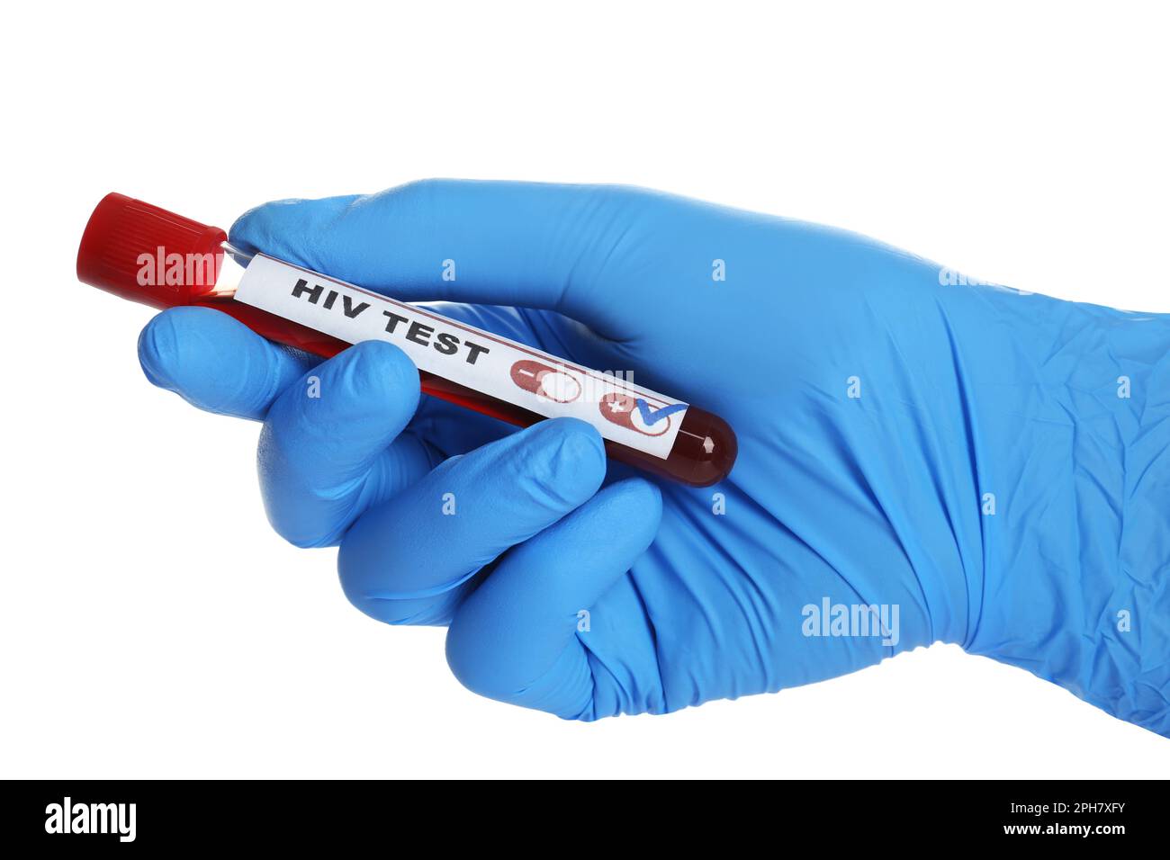 Scientist holding tube with blood sample and label HIV Test on white ...