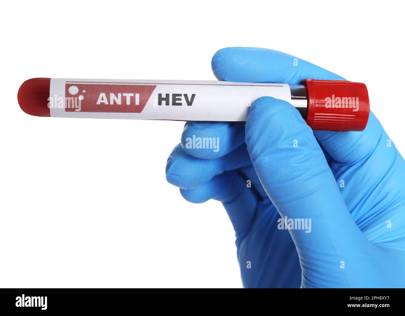 Scientist holding tube with blood sample and label Anti HEV on white ...