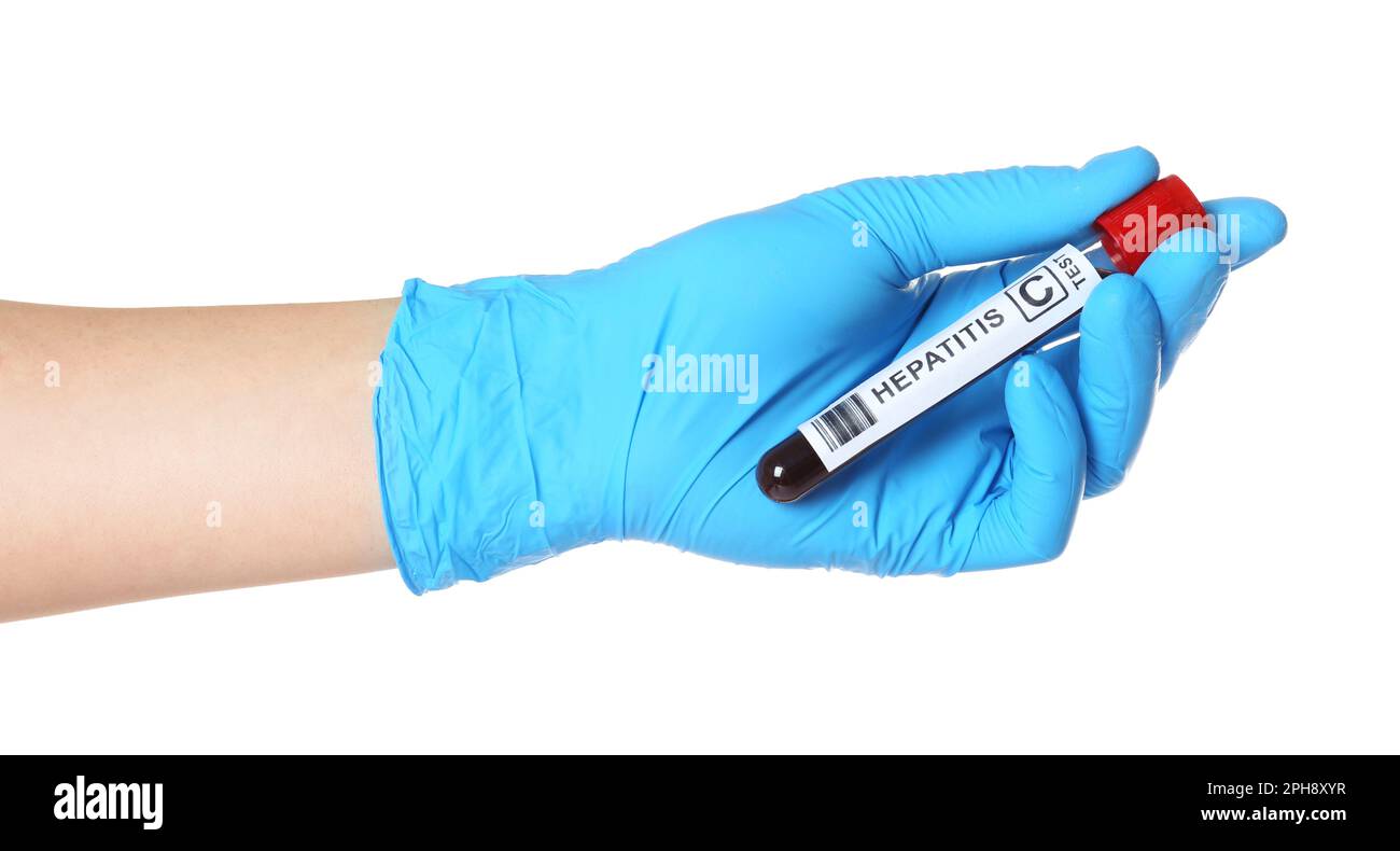 Scientist holding tube with blood sample and label Hepatitis C on white ...