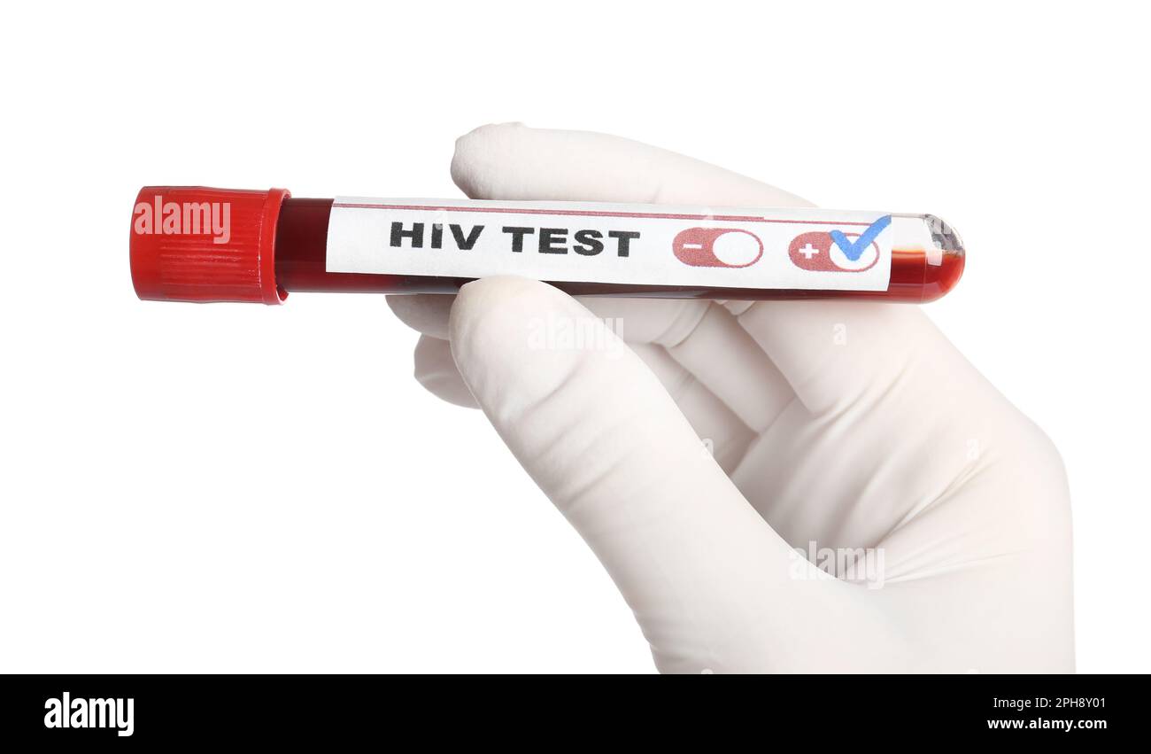 Scientist holding tube with blood sample and label HIV Test on white ...