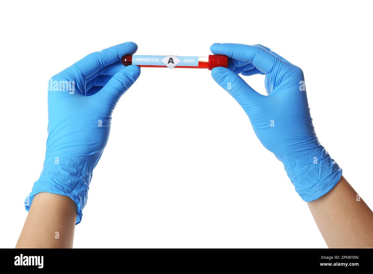 Scientist holding tube with blood sample and label Hepatitis A Test on ...
