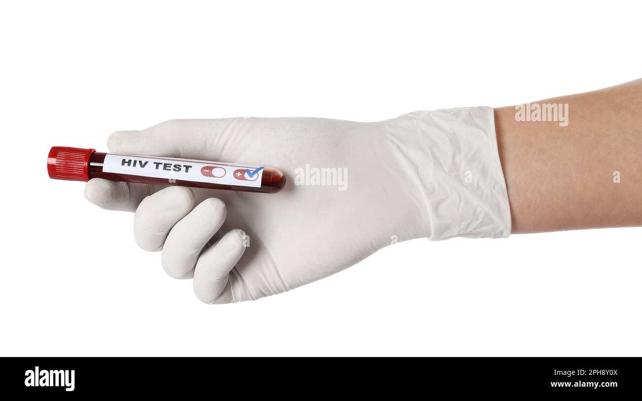 Scientist holding tube with blood sample and label HIV Test on white ...