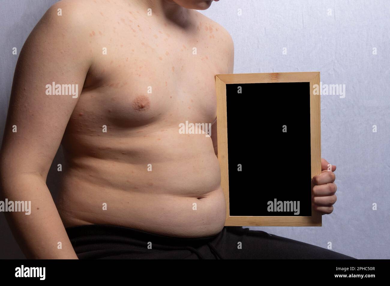 An overweight caucasian teenage boy holding a blank blackboard Stock ...