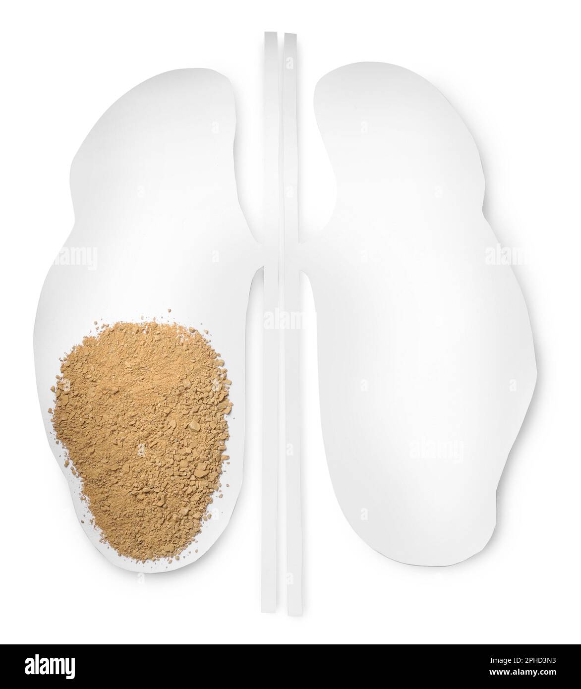 Paper cutout with sand on white background, top view. Kidney stone ...