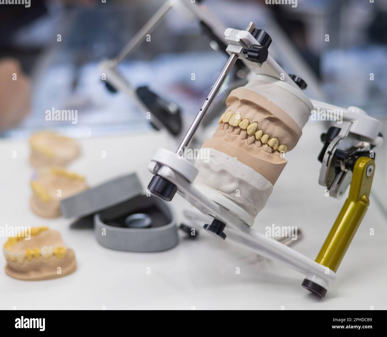 Plaster cast of the jaw in the articulator in the prosthetic workshop ...