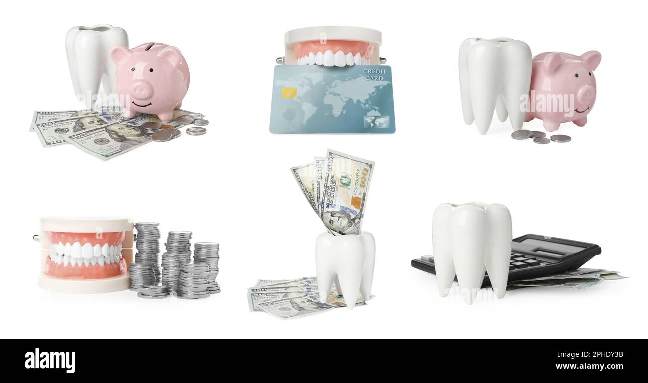 Set with educational dental models and money on white background ...