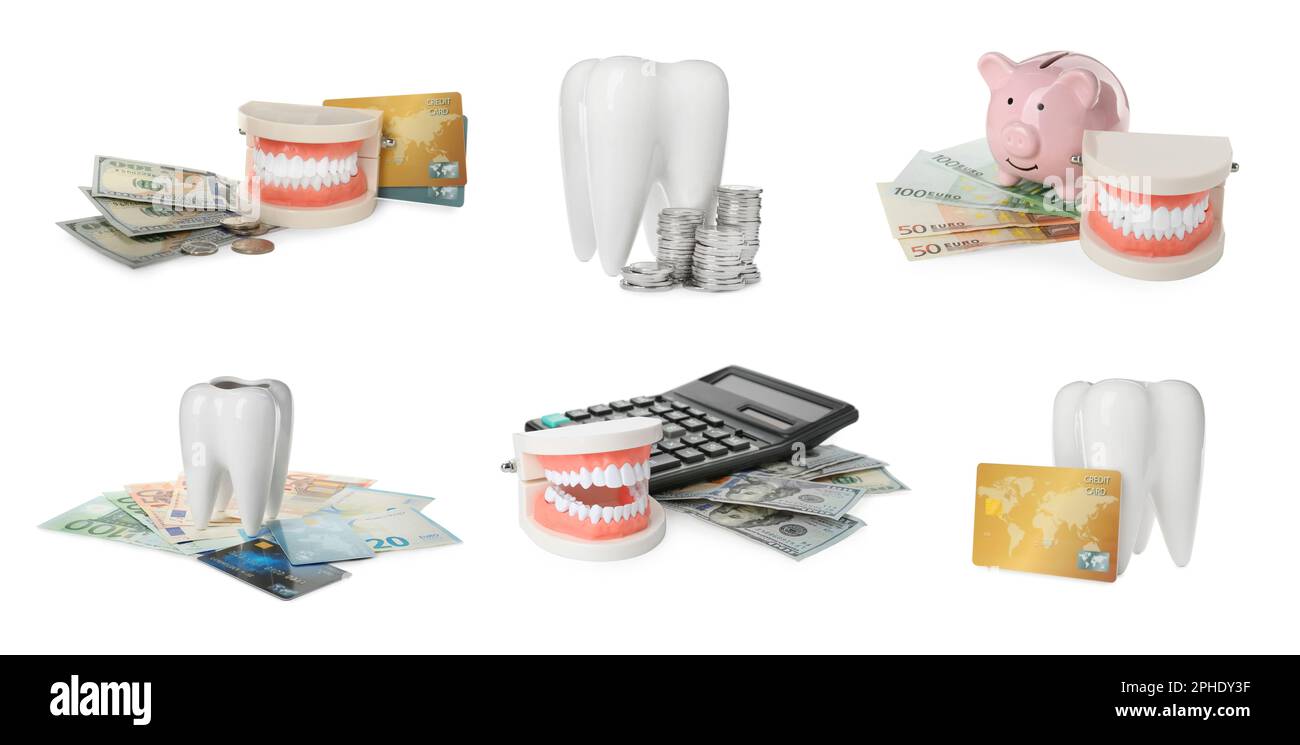 Set with educational dental models and money on white background ...