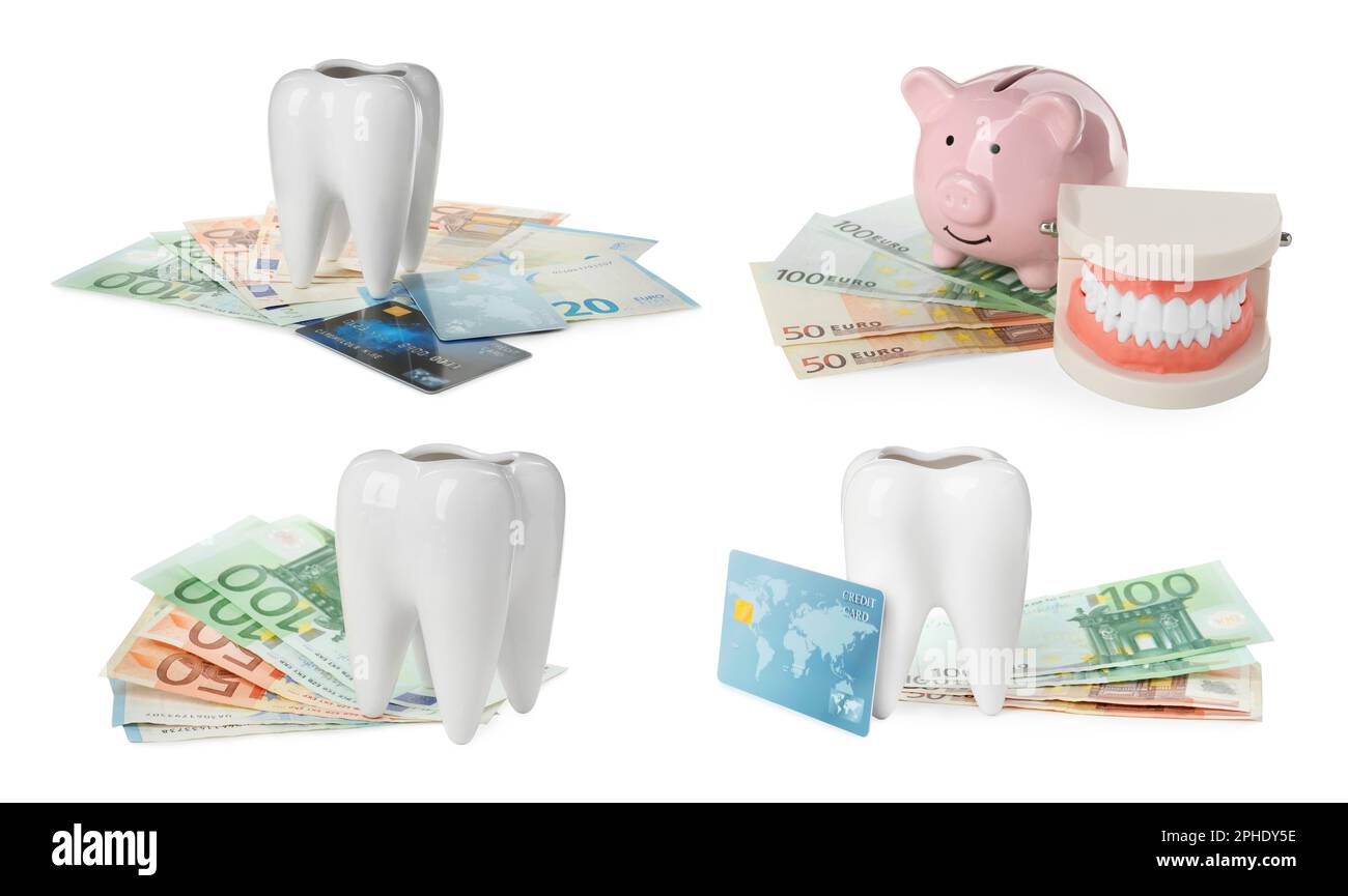 Set with educational dental models and money on white background ...