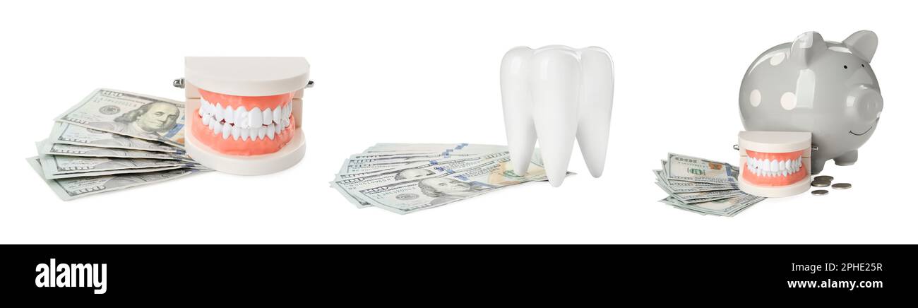 Set with educational dental models and money on white background ...