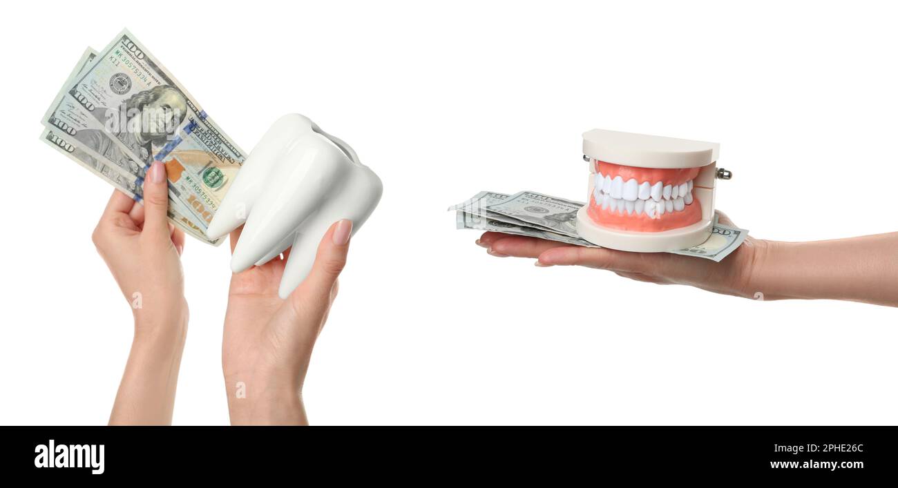 Collage with photos of women holding educational typodont, ceramic ...