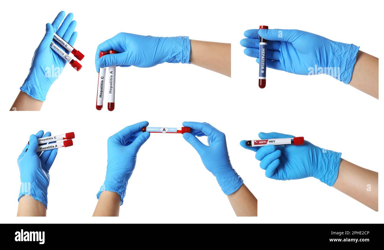 Collage with photos of scientists holding test tubes with blood samples ...