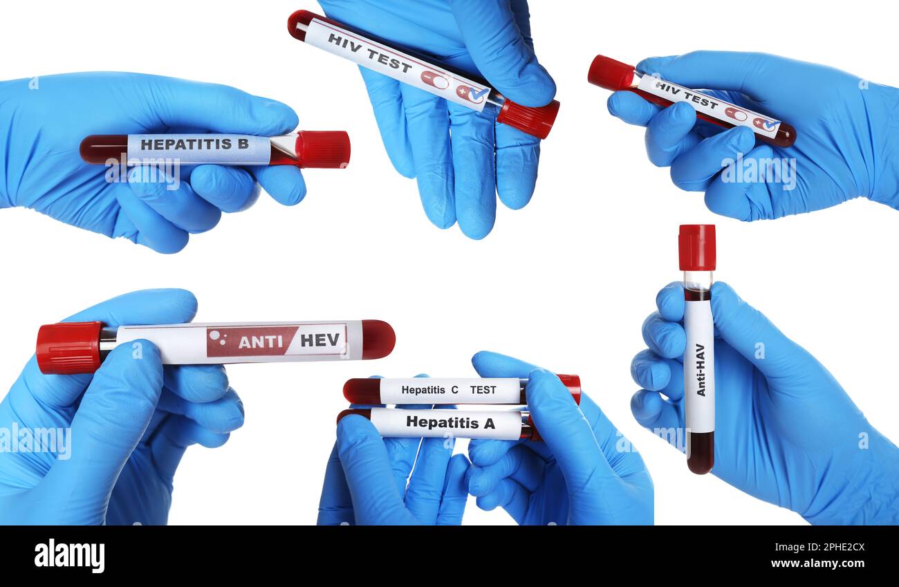 Collage with photos of scientists holding test tubes with blood samples ...