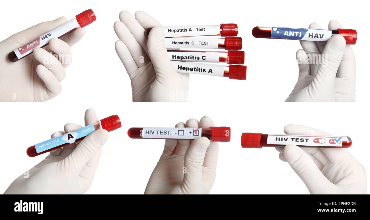 Collage with photos of scientists holding test tubes with blood samples ...
