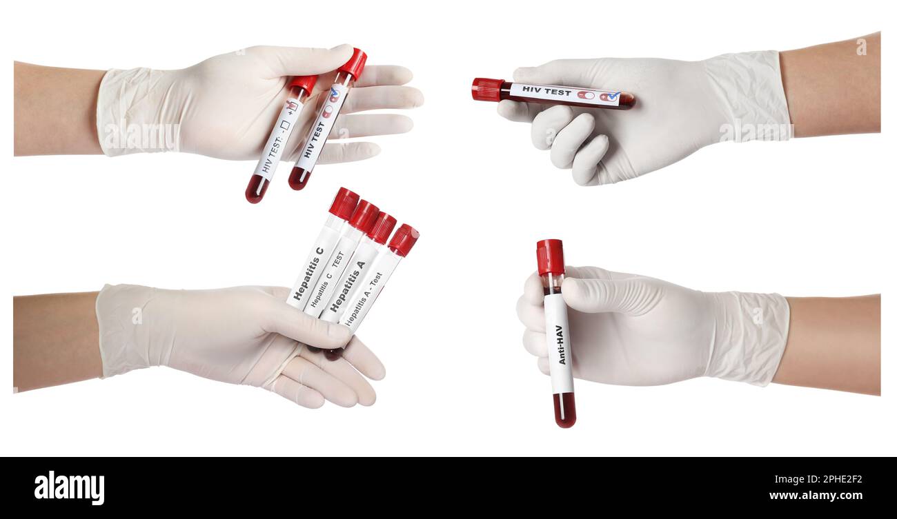 Collage with photos of scientists holding test tubes with blood samples ...