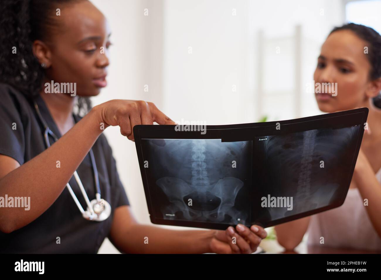 Black female doctor holds x-ray and explains diagnosis to worried ...