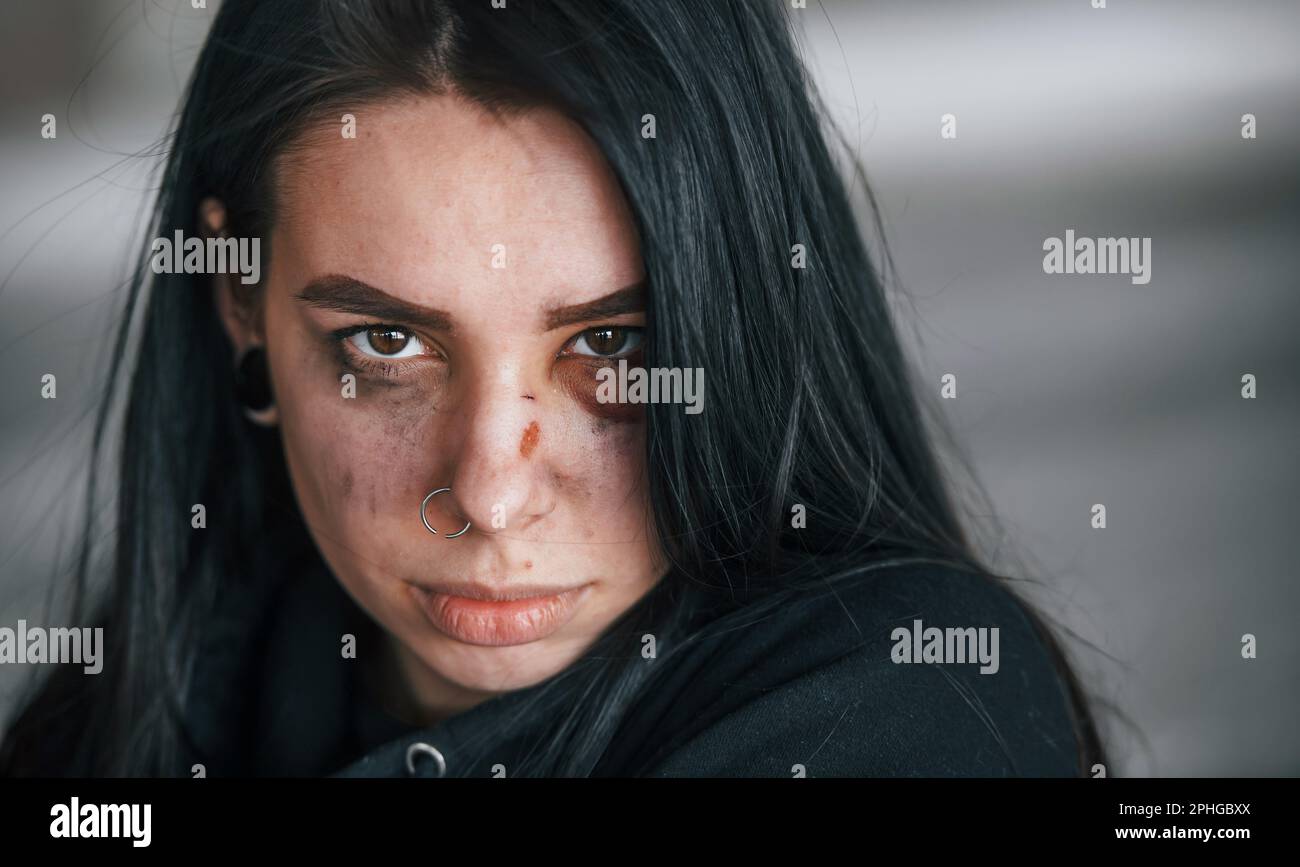 Portrait of beaten young woman with bruise under eye indoors in ...