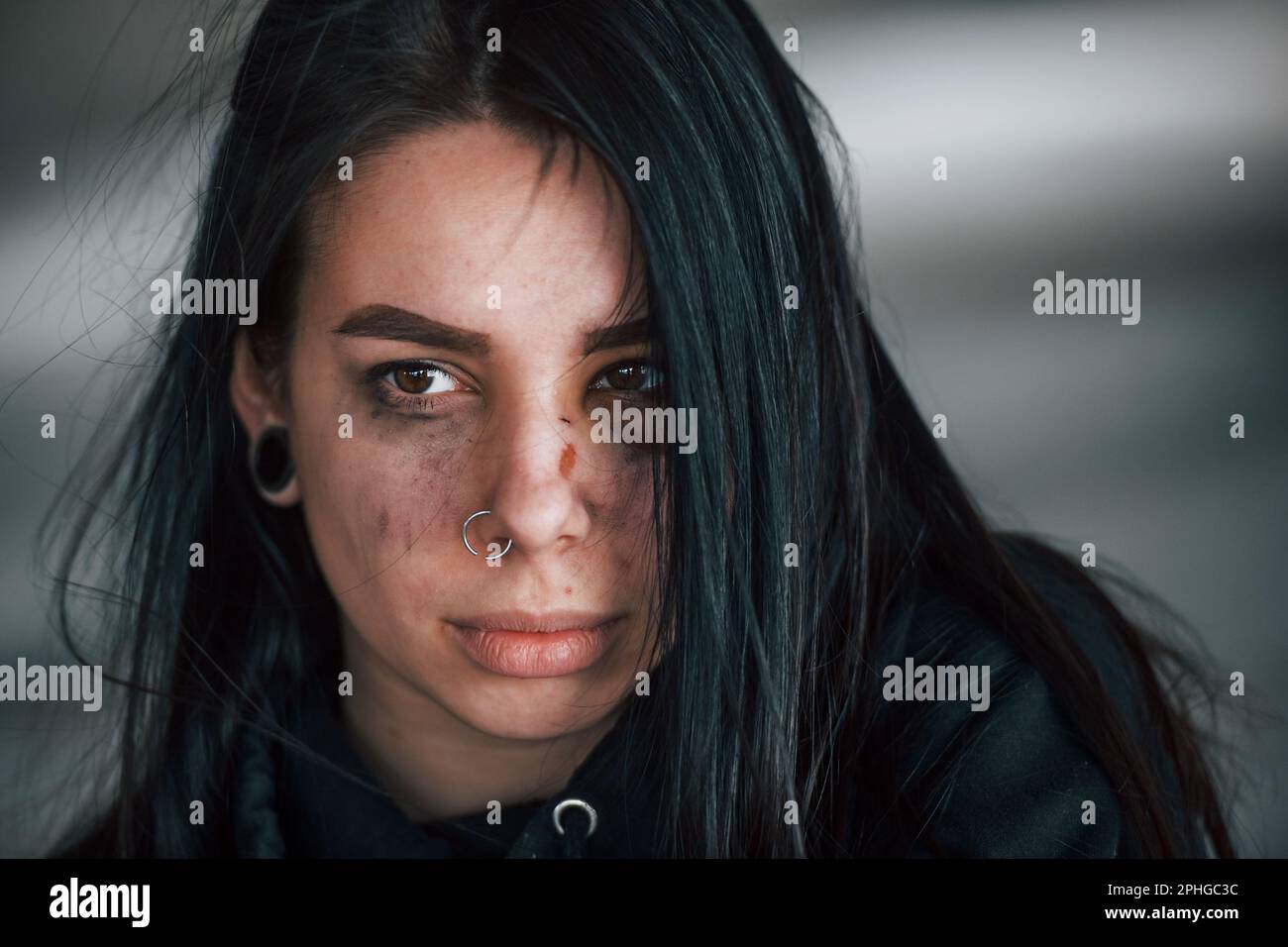 Portrait of beaten young woman with bruise under eye indoors in ...