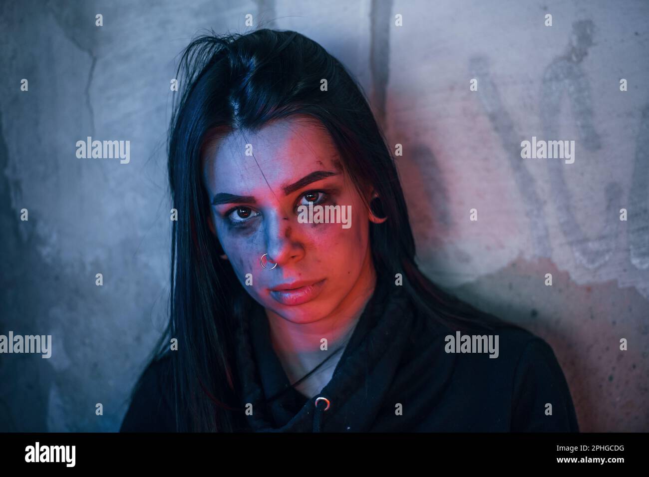 Portrait of beaten young woman with bruise under eye indoors in ...