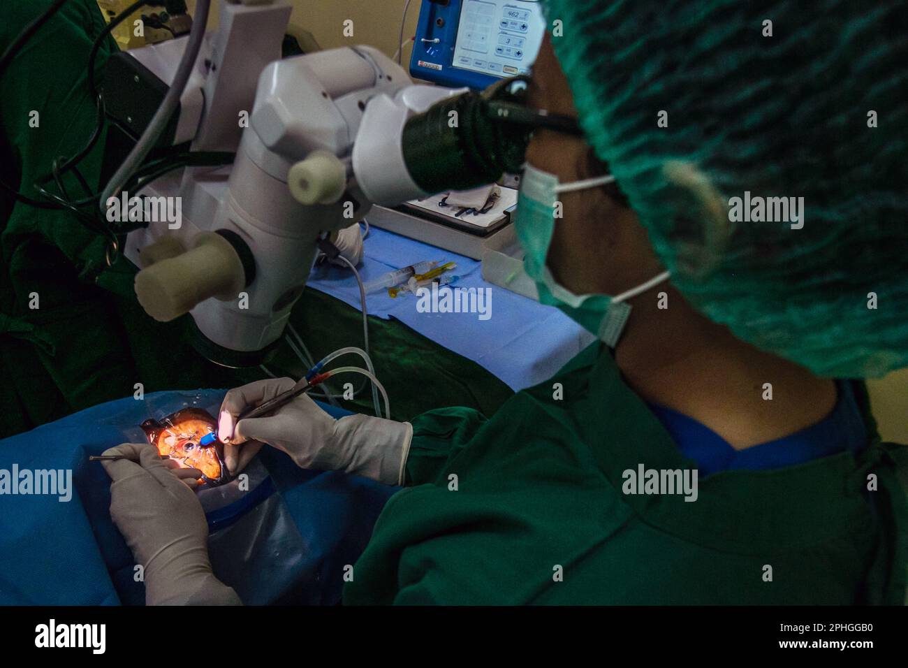 BOGOR, INDONESIA - March 27, 2023: Doctors perform cataract eye surgery ...