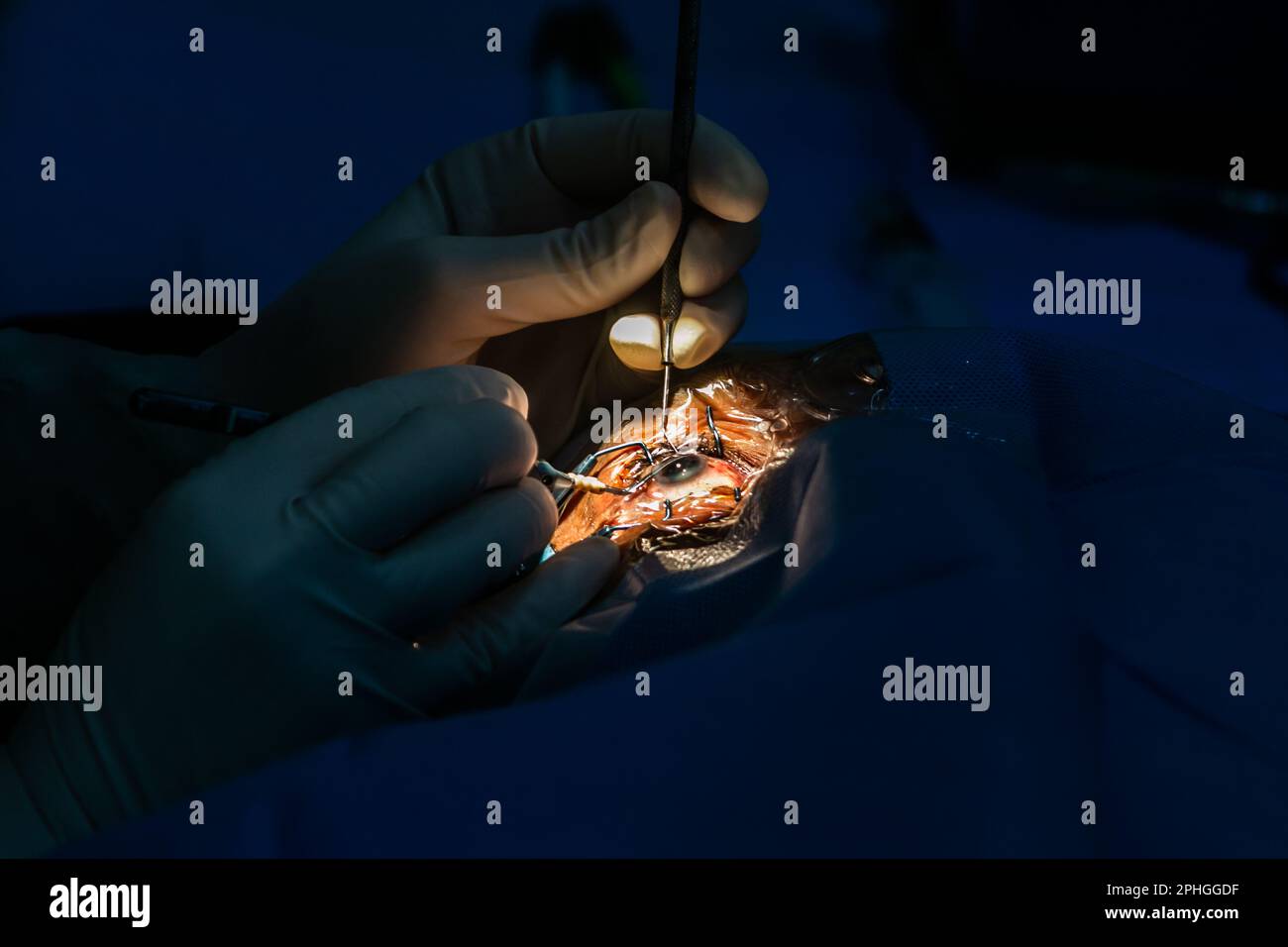 BOGOR, INDONESIA - March 27, 2023: Doctors perform cataract eye surgery ...