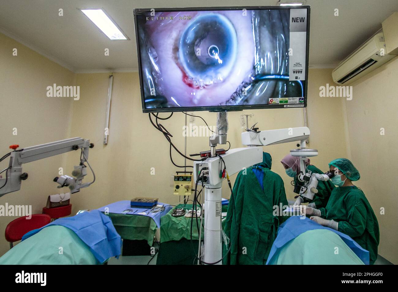 BOGOR, INDONESIA - March 27, 2023: Doctors perform cataract eye surgery ...