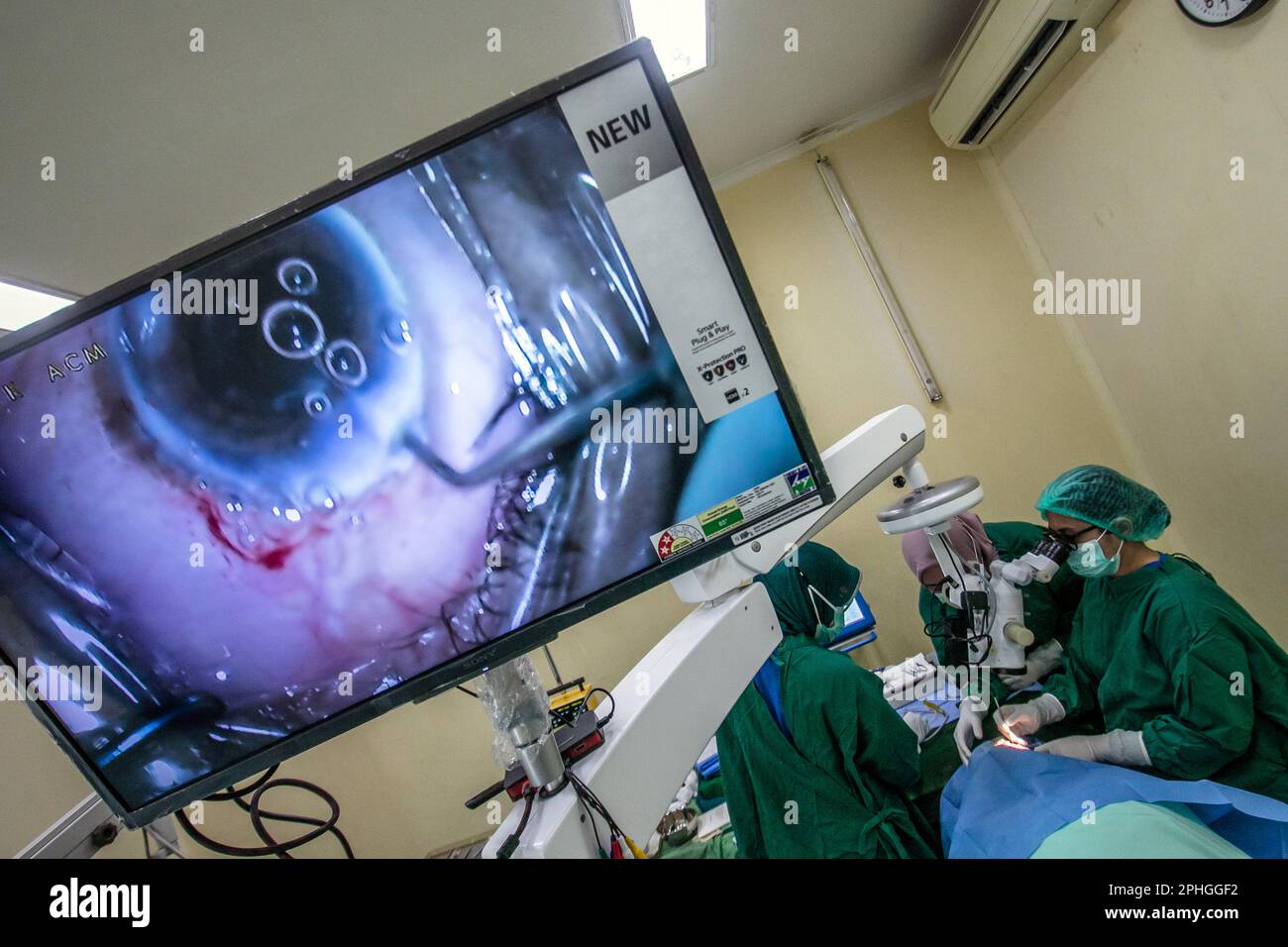 BOGOR, INDONESIA - March 27, 2023: Doctors perform cataract eye surgery ...