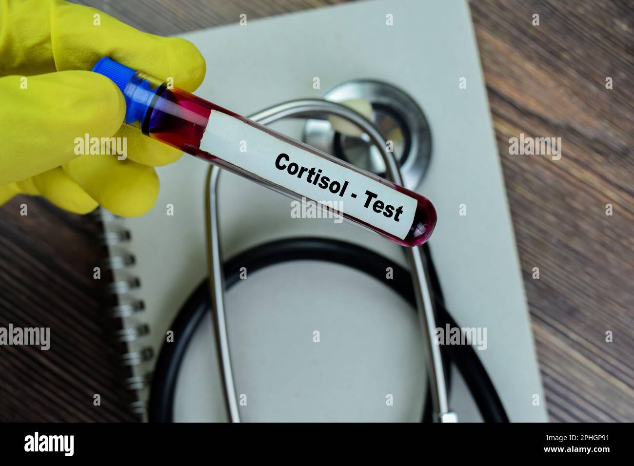 Concept of Cortisol - Test with blood sample. Healthcare or medical ...