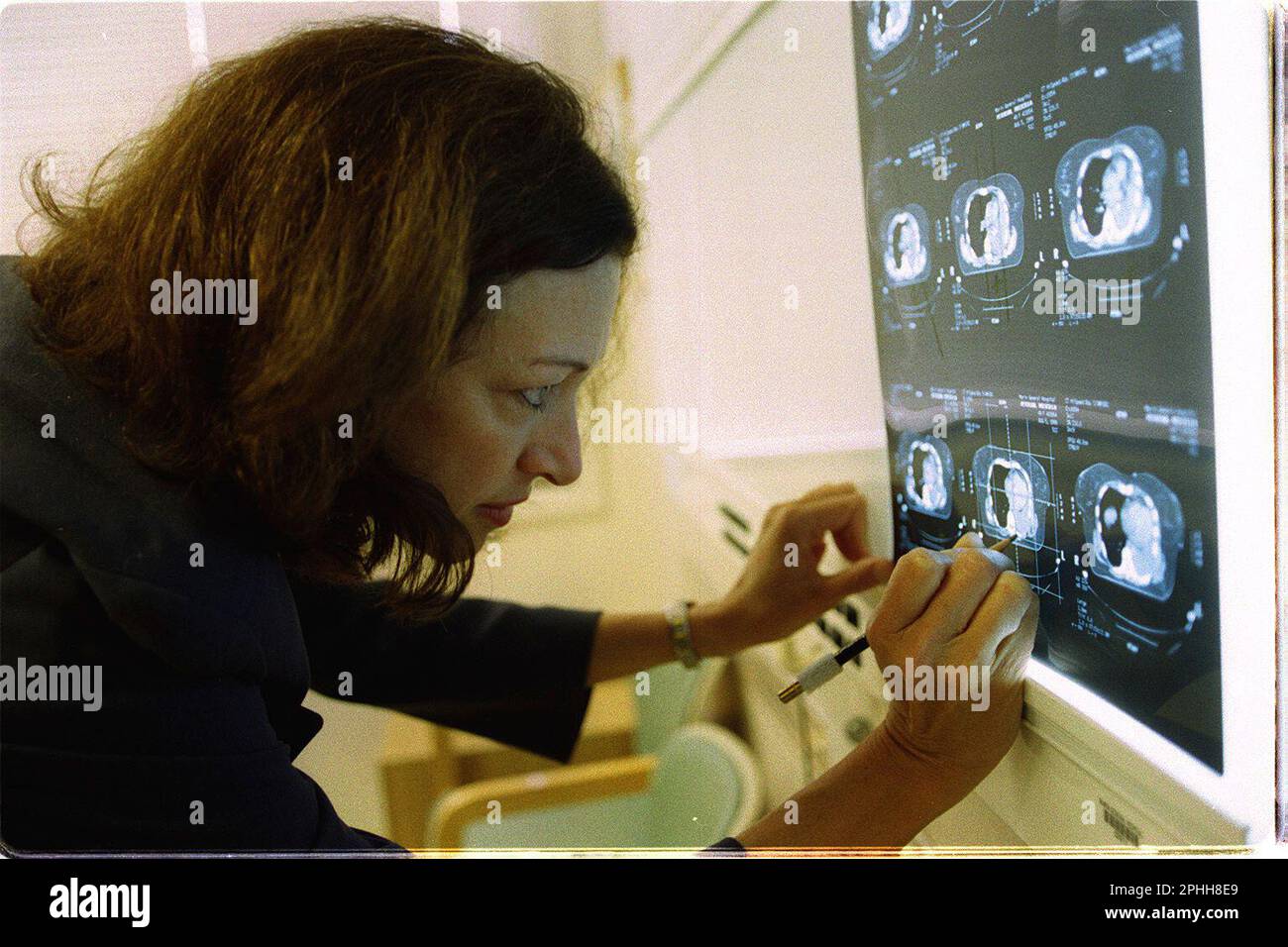NBBREASTB2-C-06AUG99-NF-LS ---- Francine Halberg, radiation oncologist ...