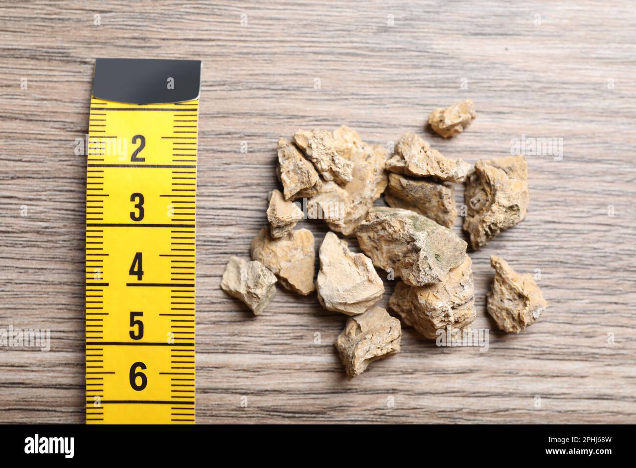 Pile of kidney stones and measuring tape on wooden table, flat lay ...