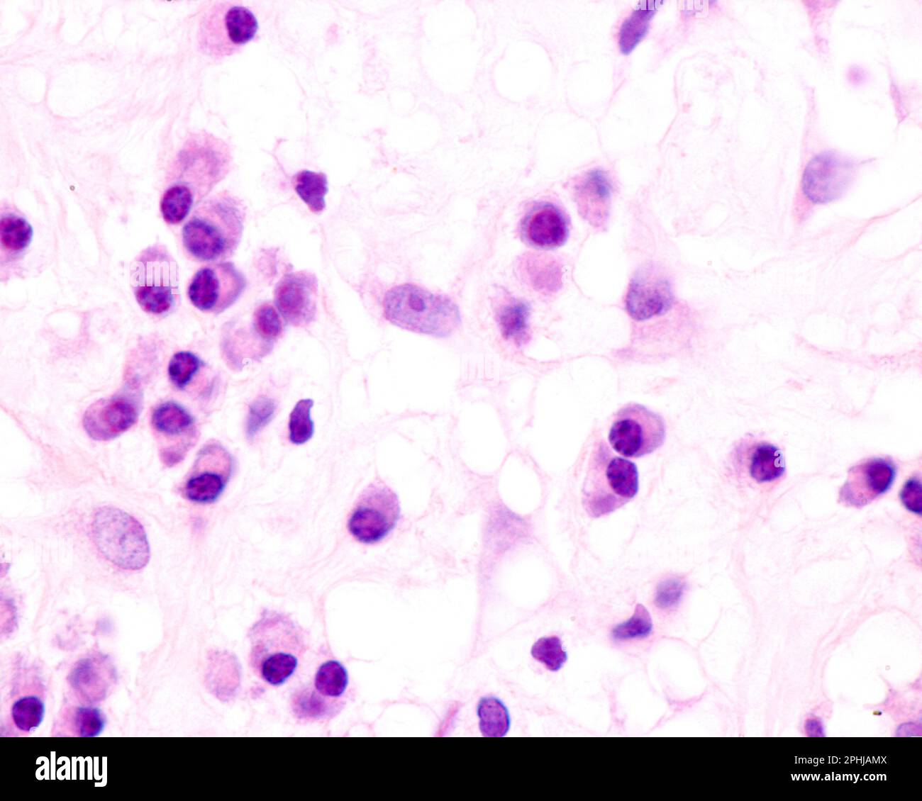 Plasma cells, light micrograph Stock Photo - Alamy